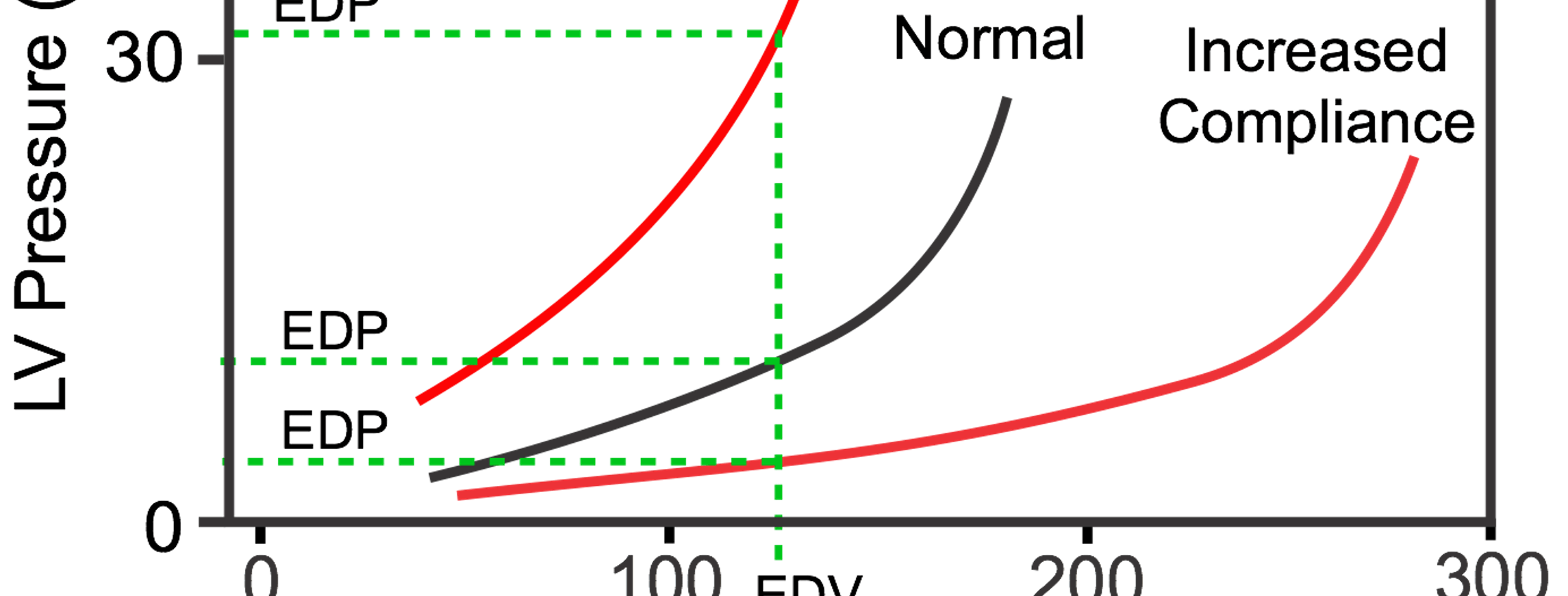 Episode 8: Why is dyspnea an anginal equivalent? – The Curious Clinicians