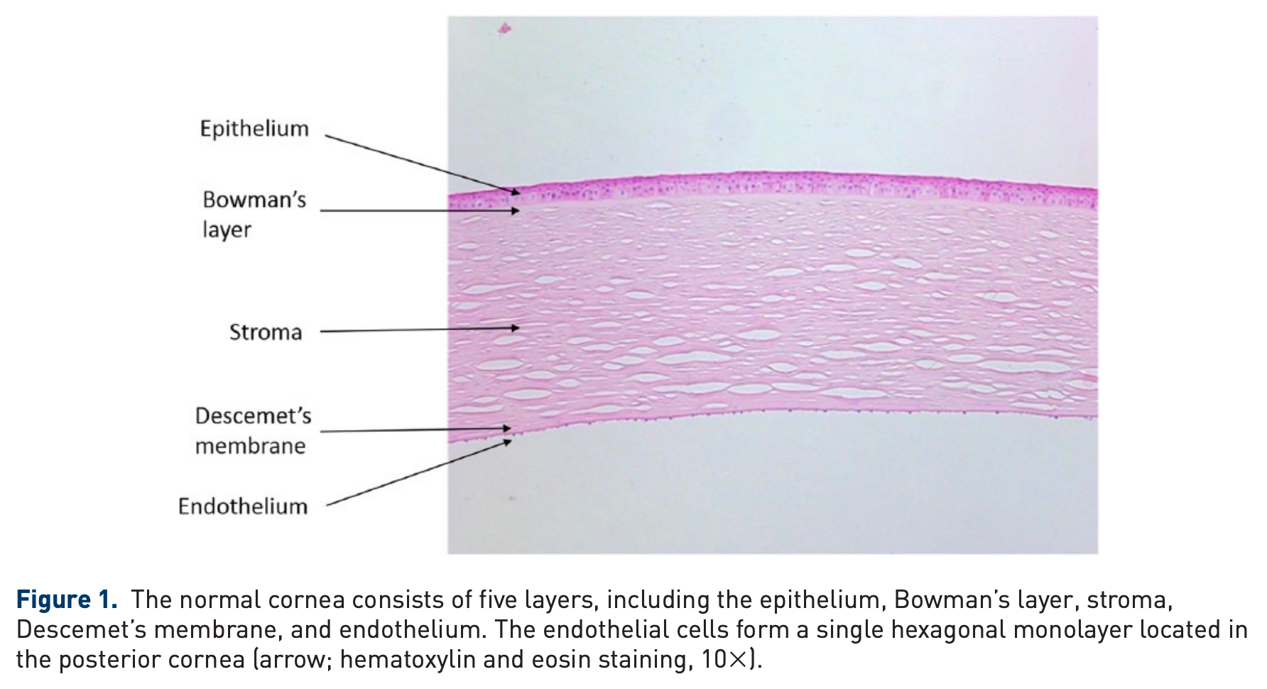 Episode 16: Why do Kayser-Fleischer rings form in the cornea in Wilson ...