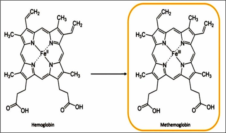 Episode 106- Pulse Check: Methemoglobin – The Curious Clinicians